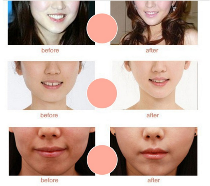 5pcs/Box Double V Line Shaped Slimming Contour Face Mask – Wise Living NZ