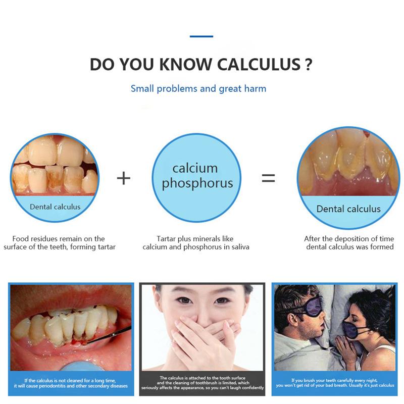 Electric Dental Calculus Plaque Remover Teeth Cleaner – Wise Living NZ